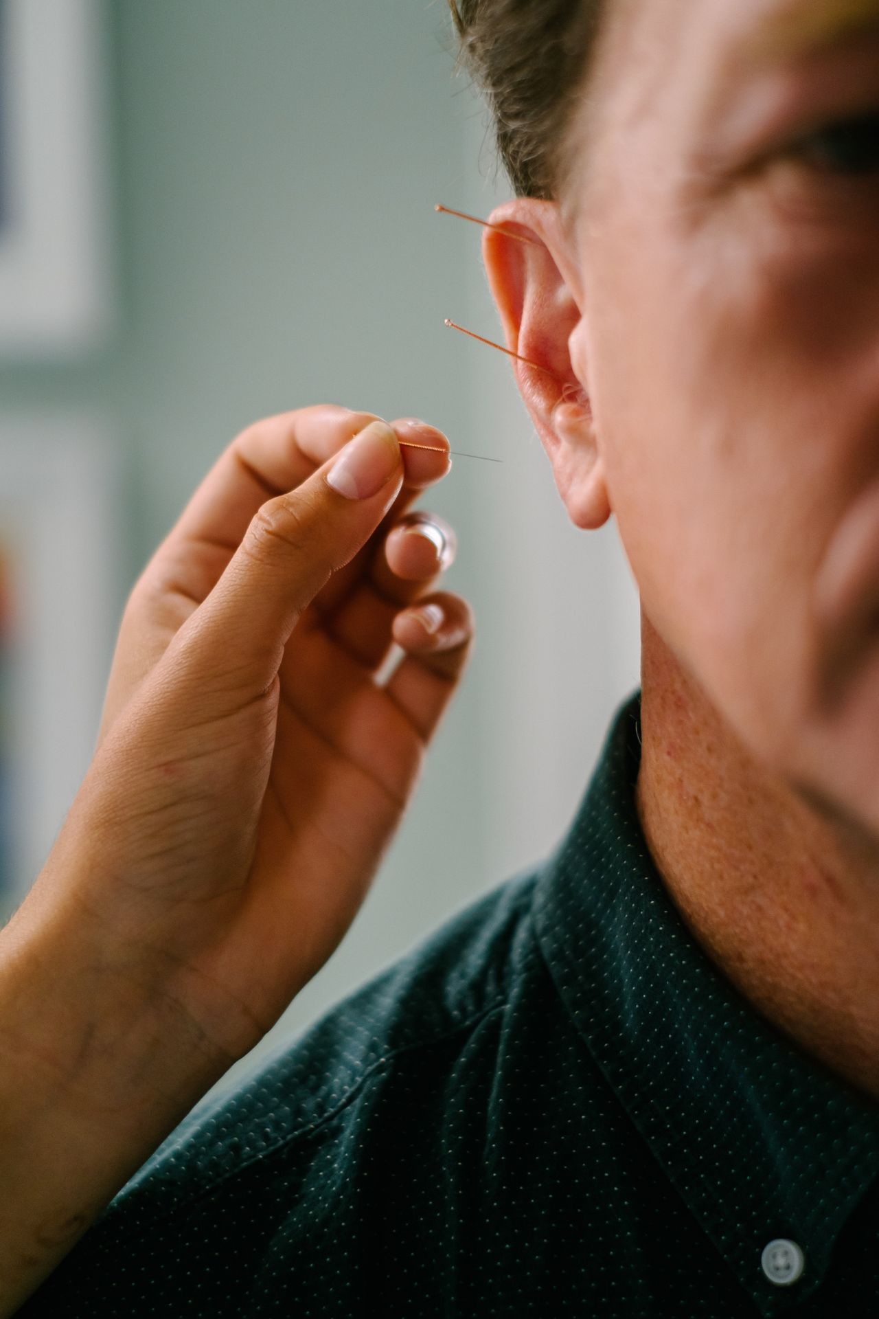 The power of auricular needling: a journey through my practice - BAcC